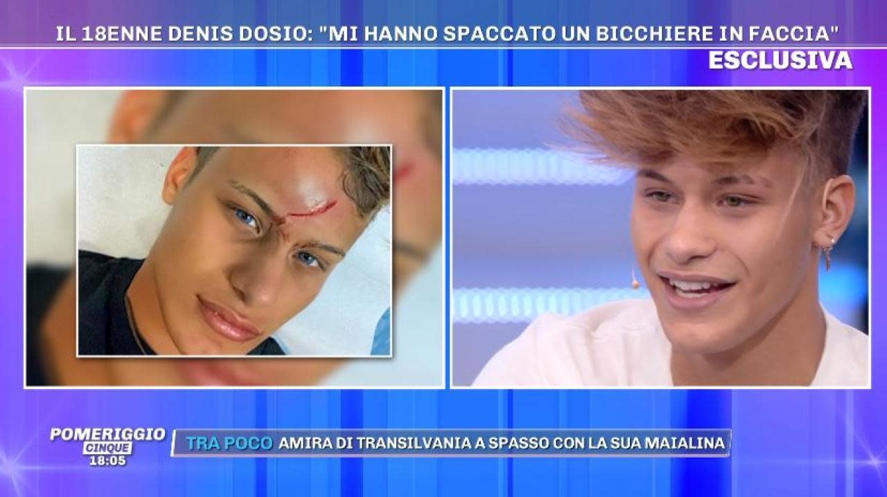 Denis Dosio: "Mi hanno spaccato un bicchiere in faccia" | Mediaset Infinity